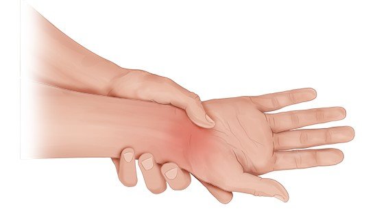Handgelenksverletzungen | Gesundheitsinformation.de